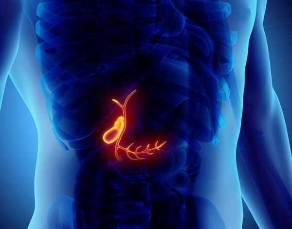 Gallstones - Colorectal and Gastro Clinic | Colon Cancer | Colonoscopy ...